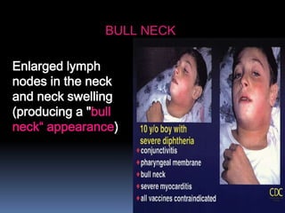 Corynebacterium diphtheria clinical diagnosis | PPTX