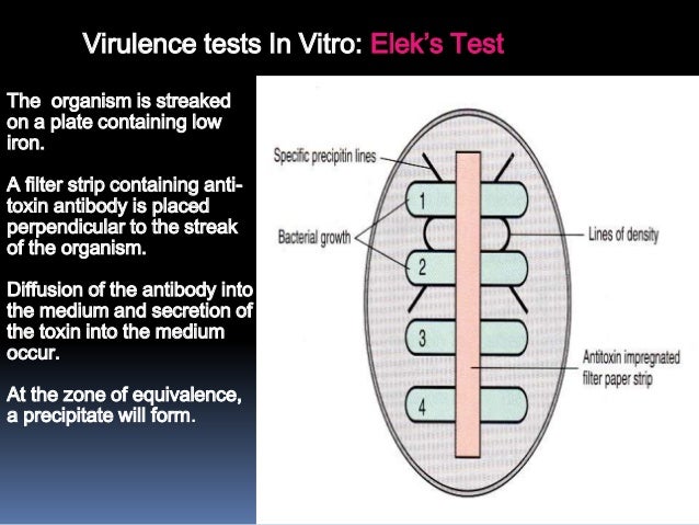 Corynebacterium diphtheria clinical diagnosis