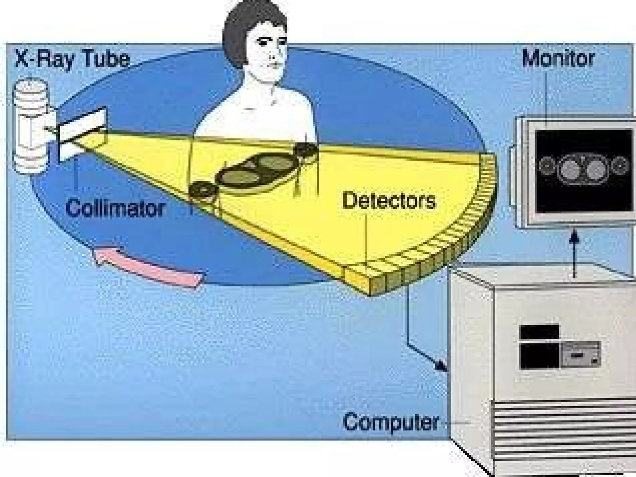 CT ITS BASIC PHYSICS | PPT