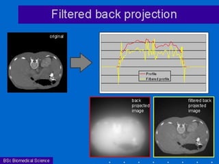 CT ITS BASIC PHYSICS | PPT