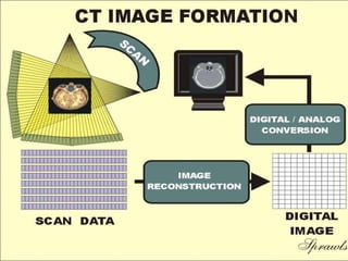 CT ITS BASIC PHYSICS | PPT