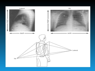 CT ITS BASIC PHYSICS | PPT