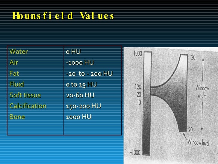 CT ITS BASIC PHYSICS