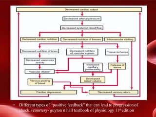 Progressive Shock | PPT