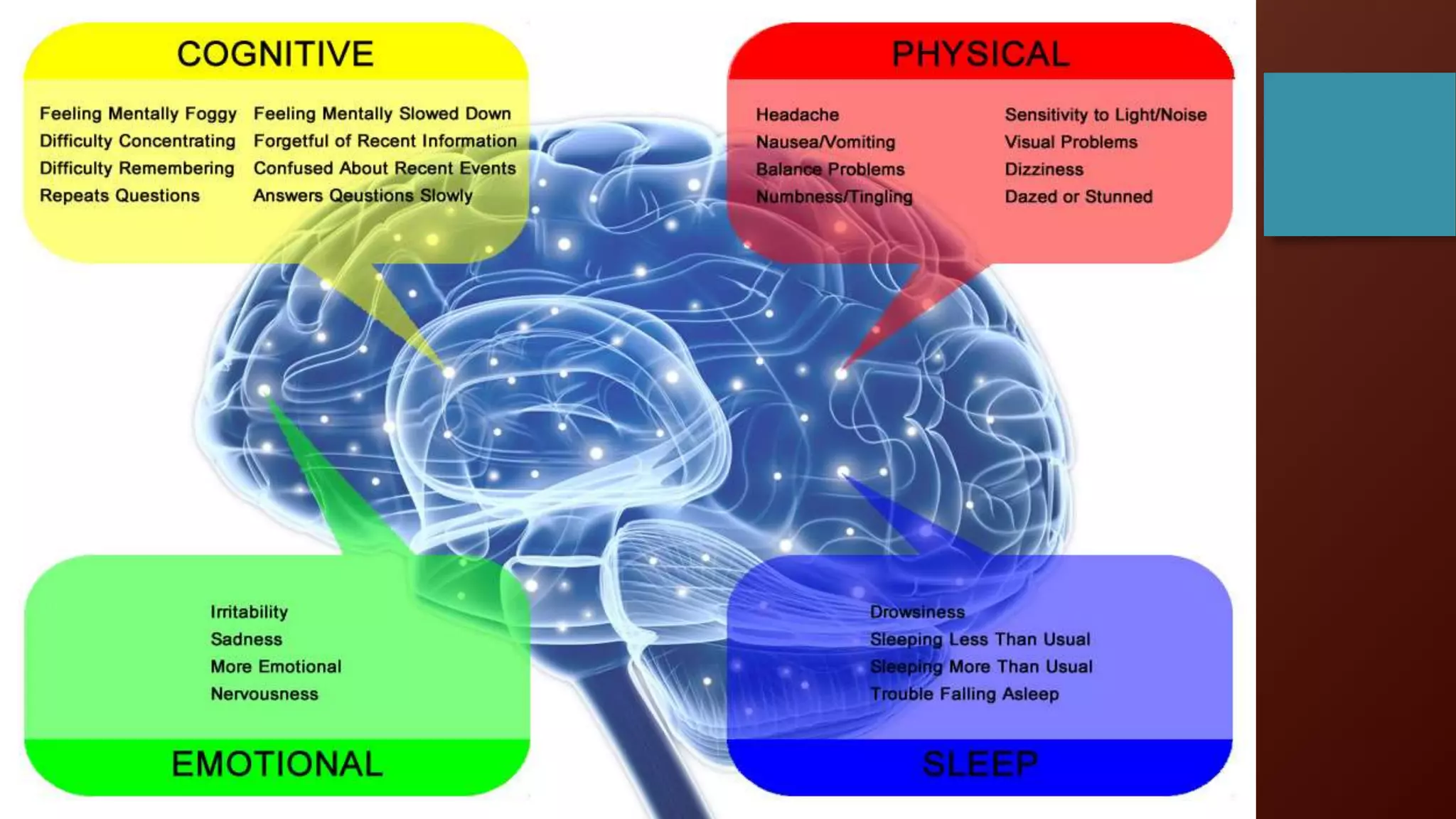 sports related head injury (concussion) | PPTX