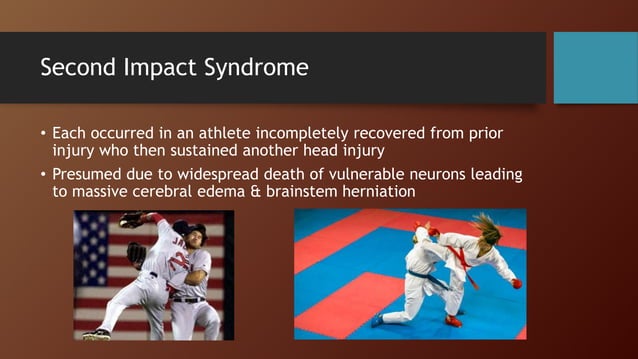 sports related head injury (concussion) | PPTX | Death, Injury, or ...