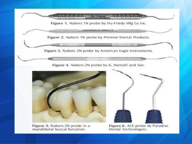 FURCATION INVOLVEMENT AND ITS MANAGEMENT