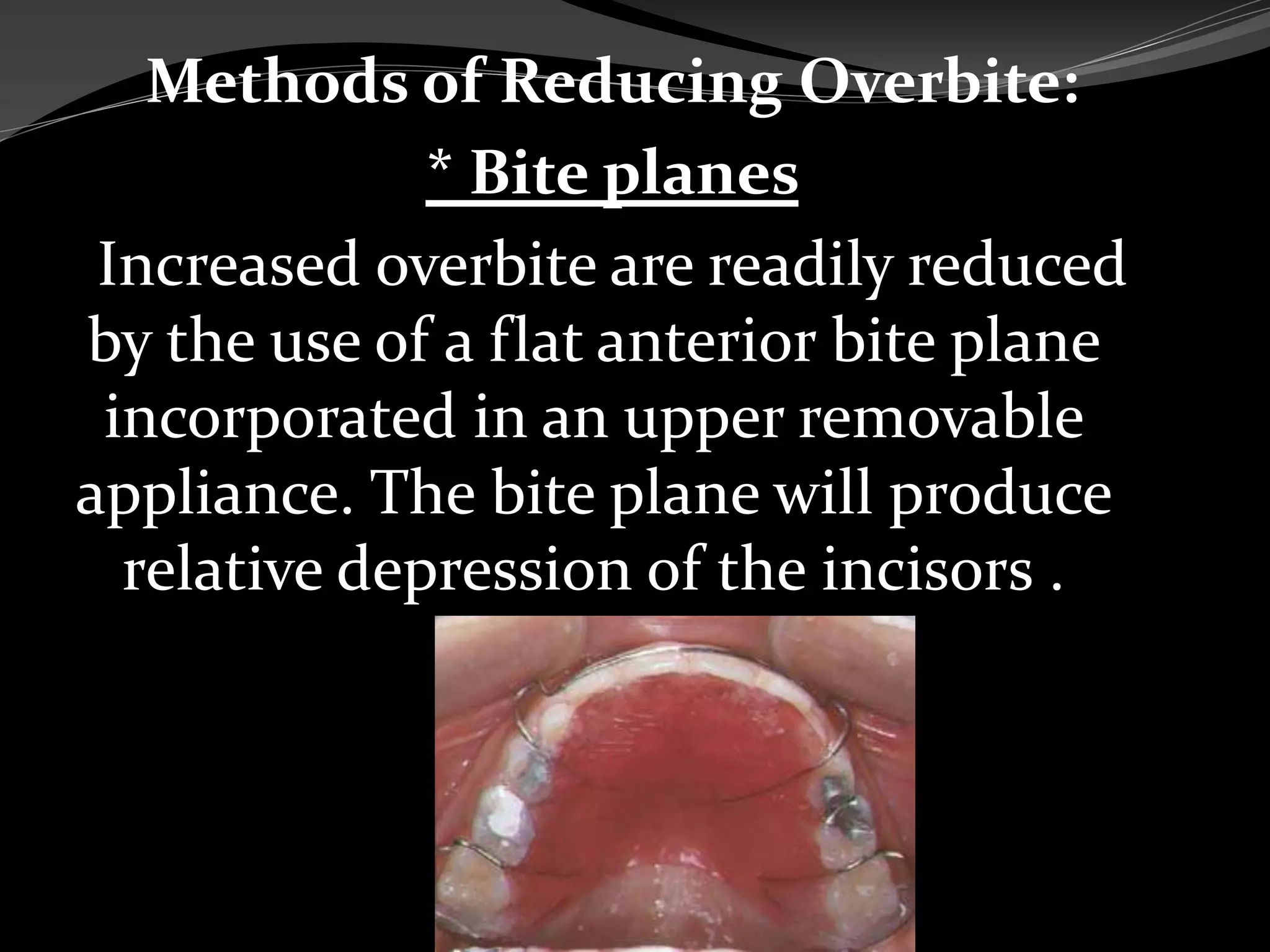 orthodontic deep bite | PPT