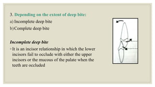 deep bite.pptx