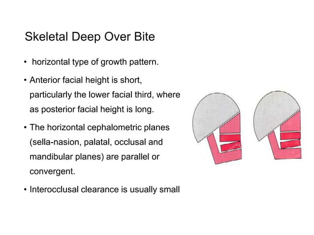 DEEP BITE..RX.ppt, orthodontic extractions | PPT