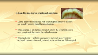 Deep bite.pptx over bite Deep bite.pptx over bite | PPT