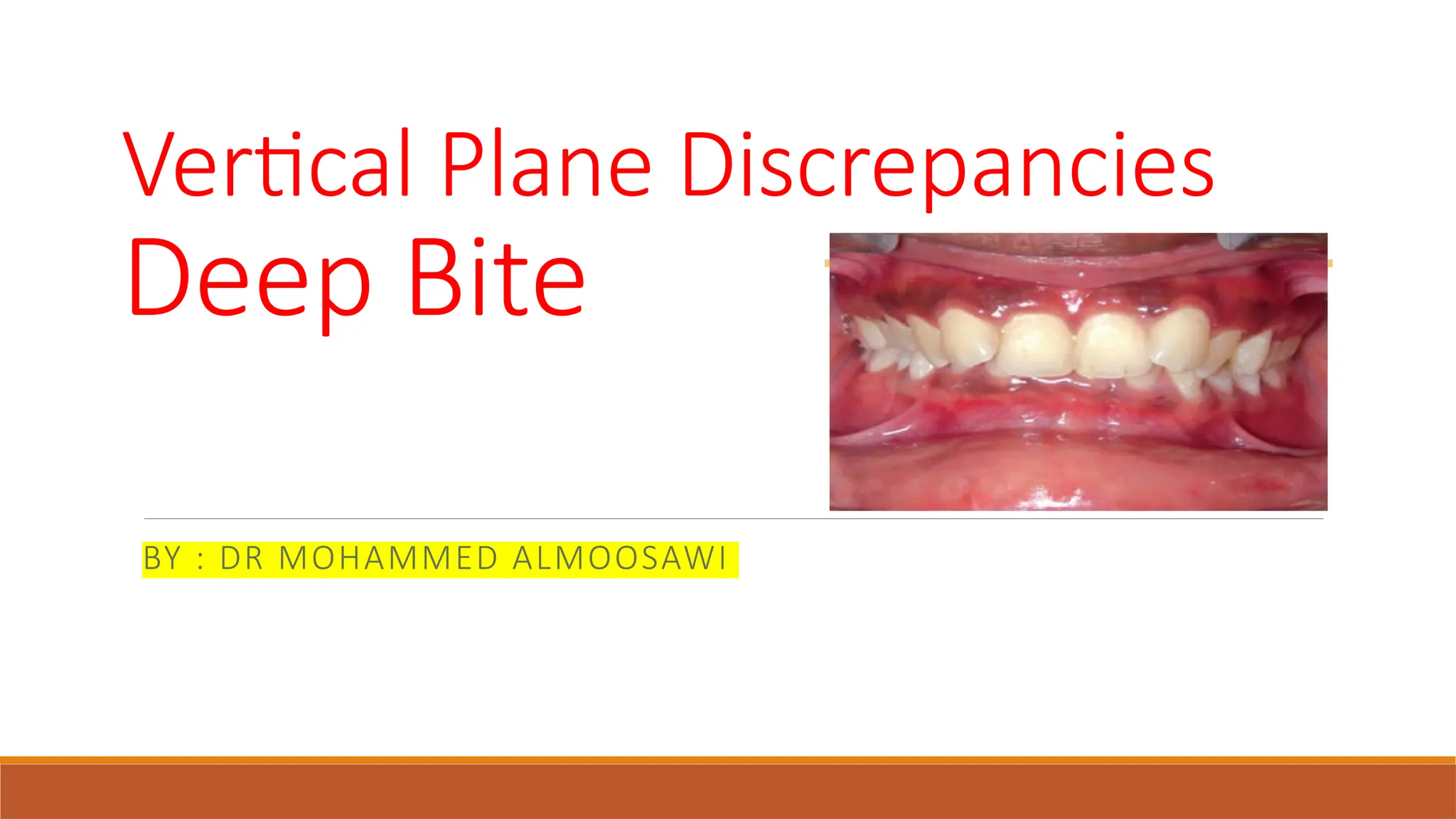 DEEP BITE \ VERTICAL PLANE DISCREPANCIES .pptx