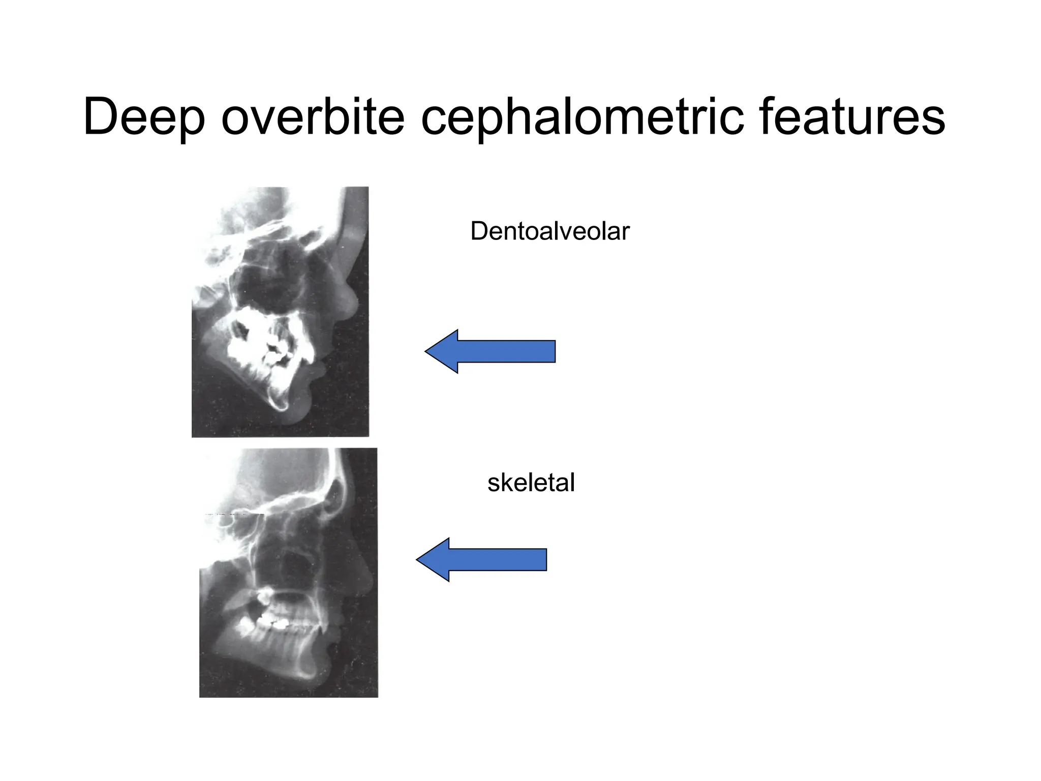 presentation on management of DEEP BITE, | PPT
