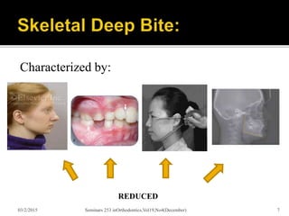 Deep bite(1) | PPTX