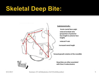 Deep bite(1) | PPTX