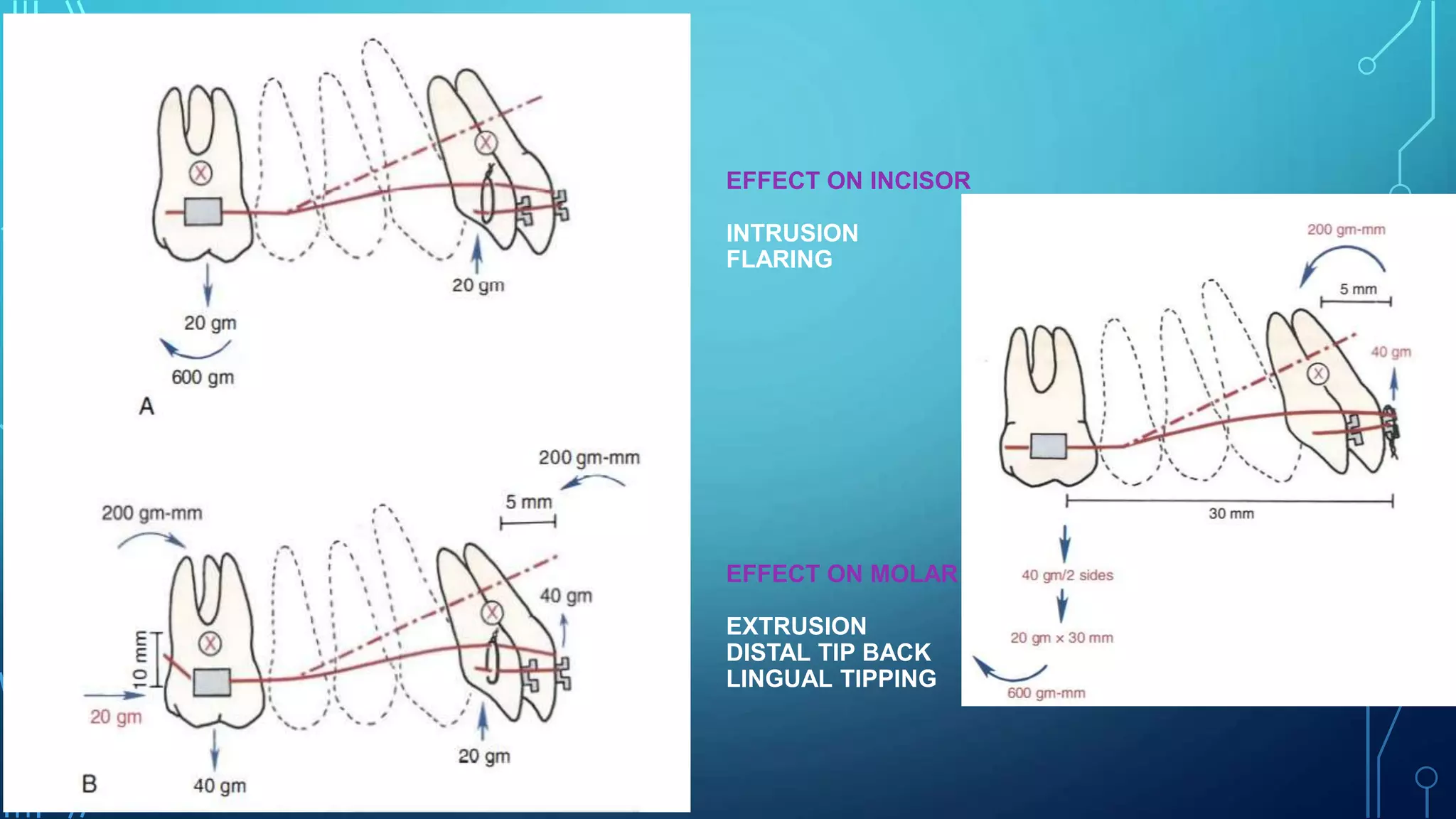 Intrusion arch | PPTX