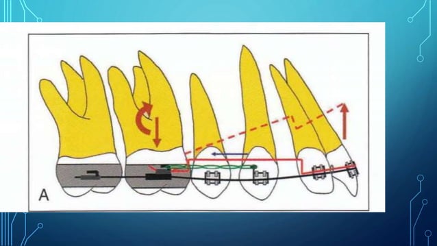 Intrusion arch | PPTX