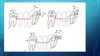 Intrusion arch | PPTX