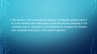 Intrusion arch | PPTX