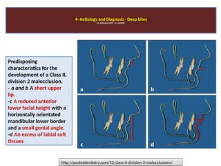 Deep bite malocclusions-M. ABOULNASER- Orthodontist, BUA, USA. O ...