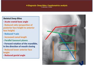 Deep bite malocclusions-M. ABOULNASER- Orthodontist, BUA, USA. O ...