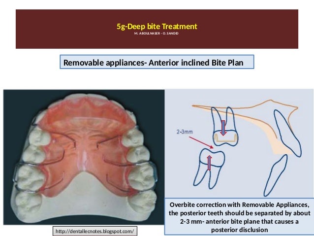 Deep bite malocclusions-M. ABOULNASER- Orthodontist, BUA, USA. O. SAN…