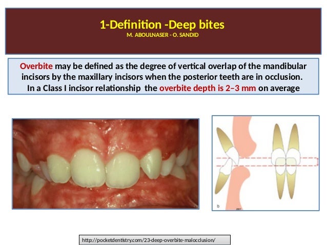 Deep bite malocclusions-M. ABOULNASER- Orthodontist, BUA, USA. O. SAN…