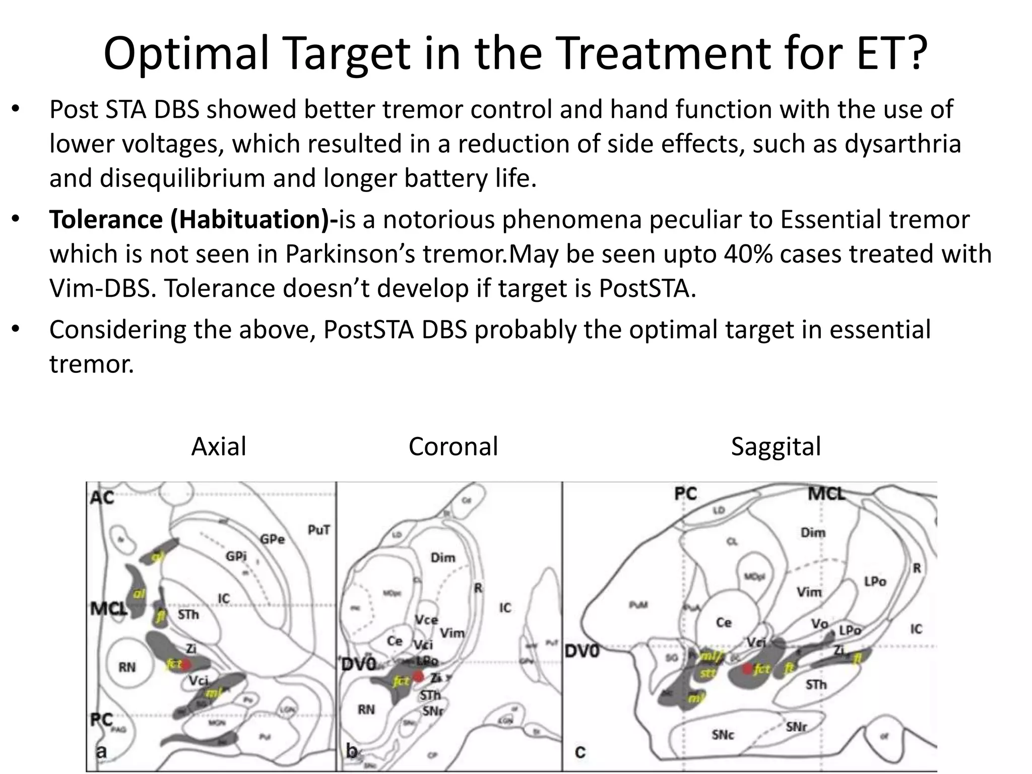 Deep Brain Stimulation | PPTX