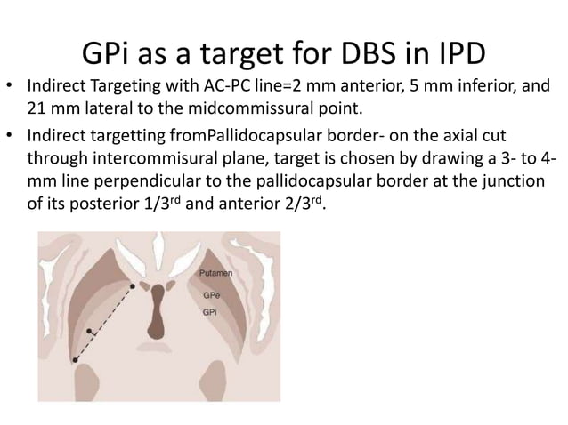 Deep Brain Stimulation | PPTX