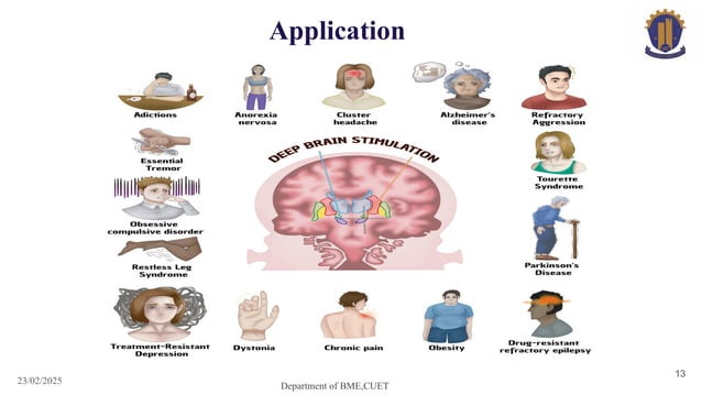Deep Brain Stimulation, a Neurosurgical Approach for Neuromodulation.pptx