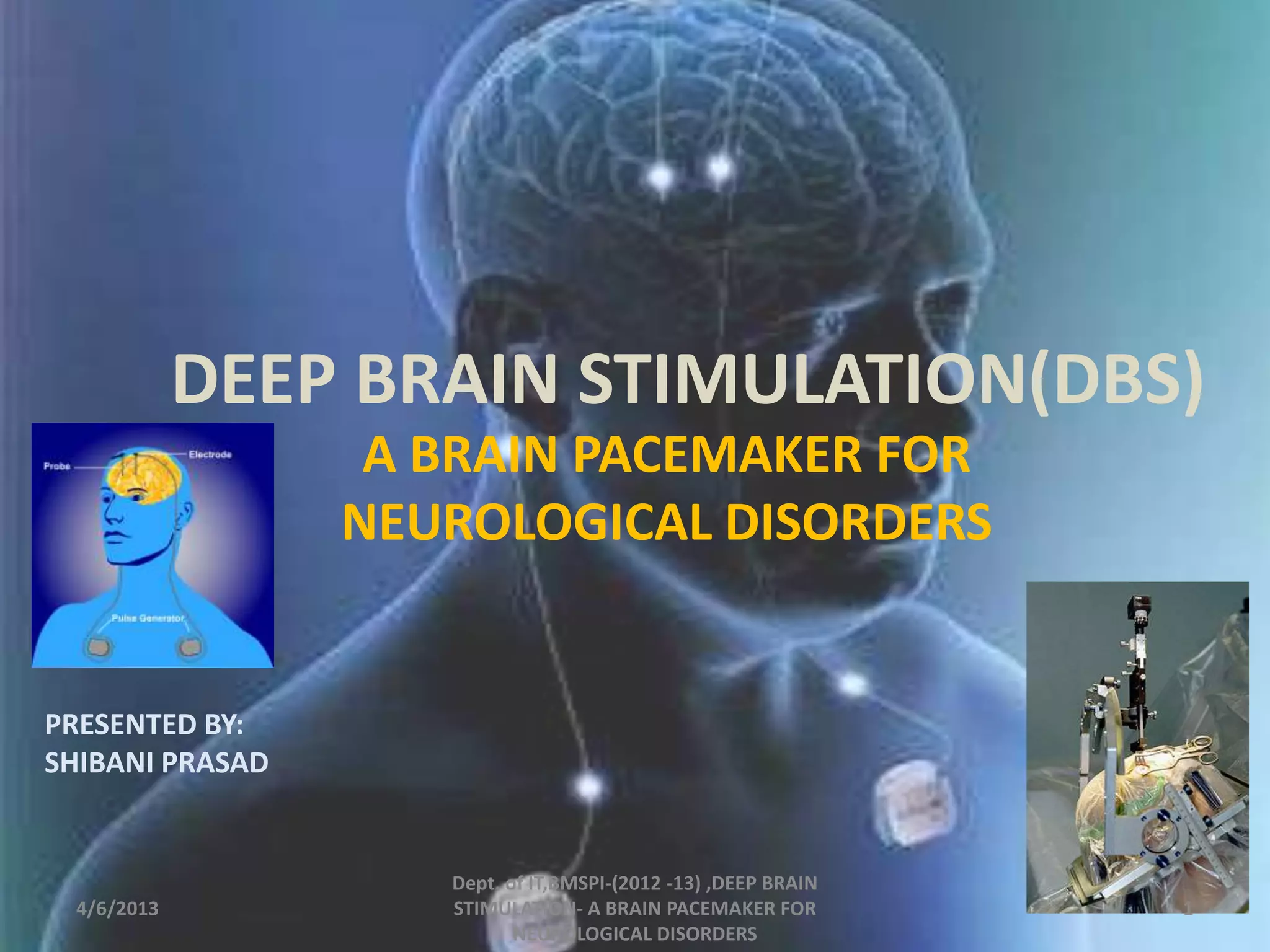 Deep brain stimulation | PPTX