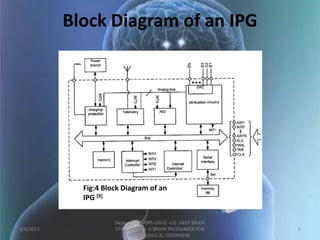 Deep brain stimulation | PPTX