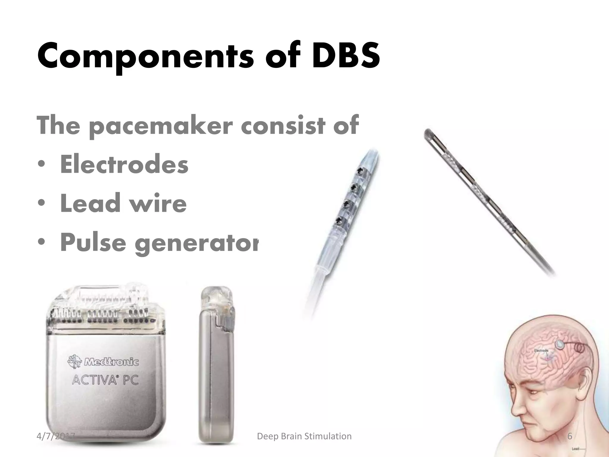 Deep brain stimulation presentation | PPTX
