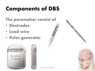 Deep brain stimulation presentation | PPTX