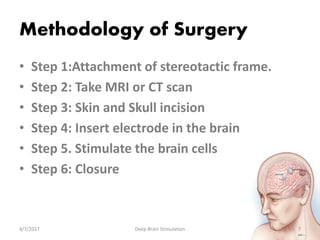 Deep brain stimulation presentation | PPTX