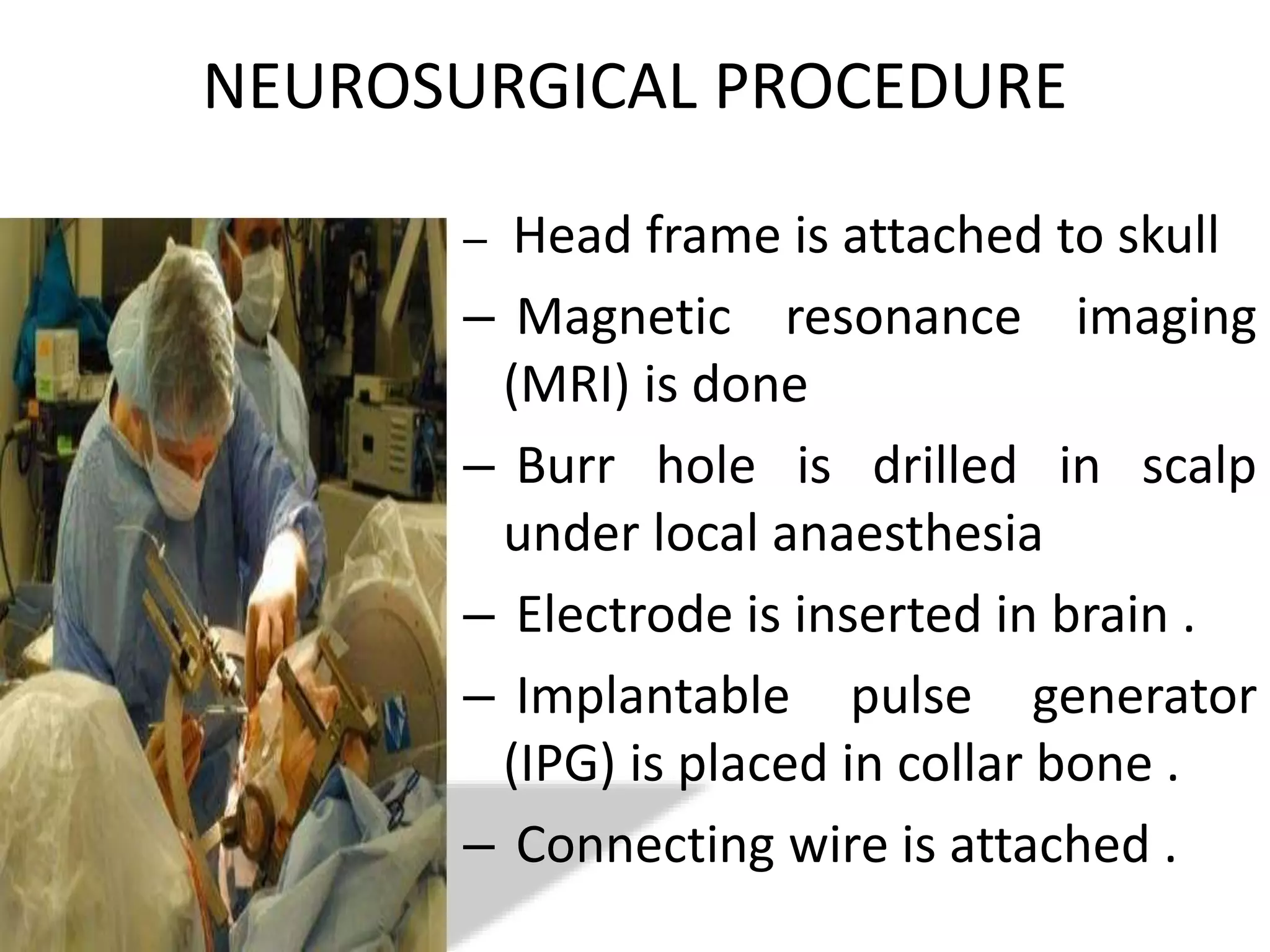 Deep brain stimulators ppt | PPTX