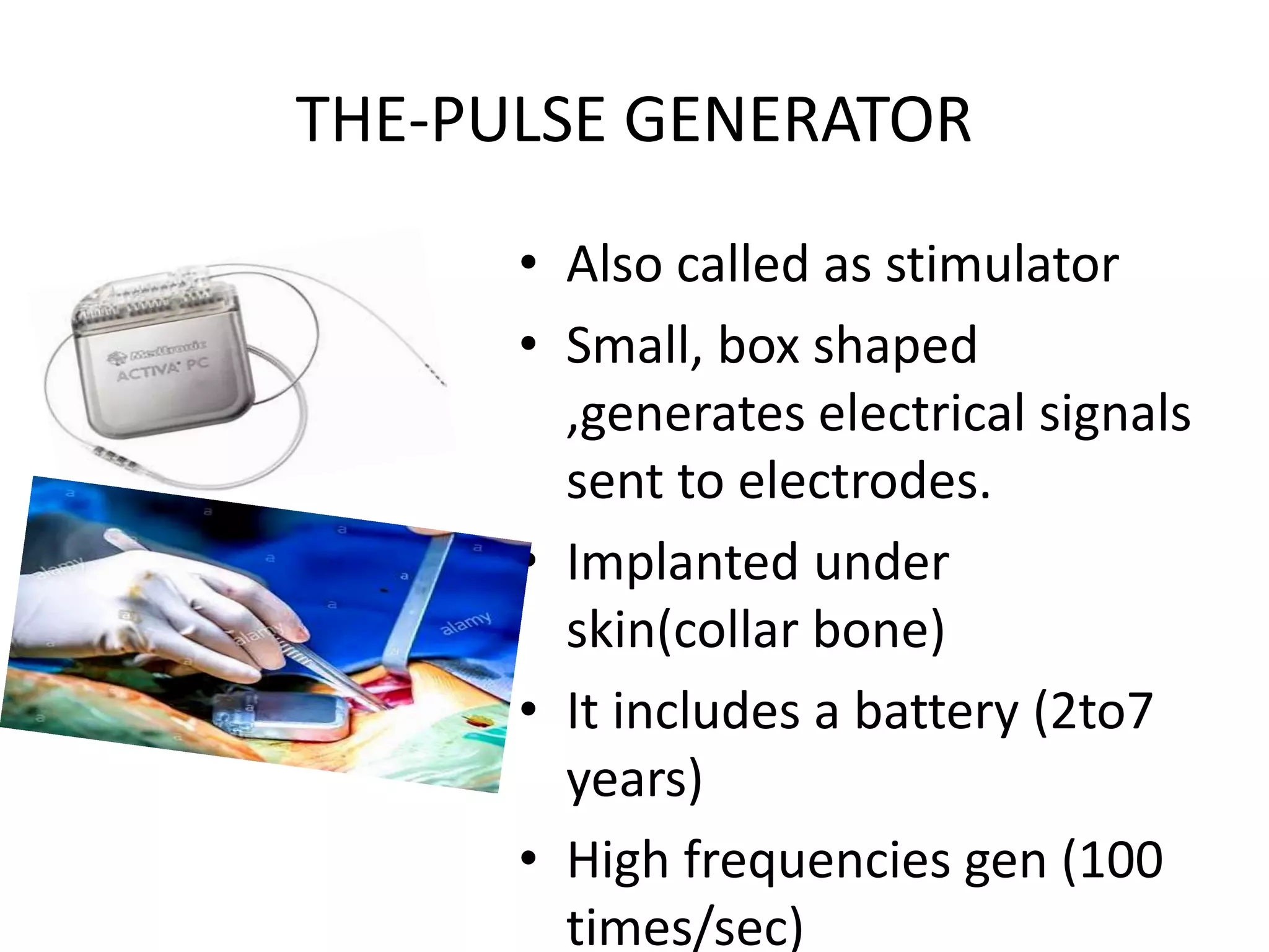 Deep brain stimulators ppt | PPTX