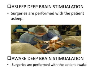 Deep brain stimulators ppt | PPTX