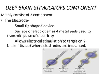 Deep brain stimulators ppt | PPTX | Brain and Nervous System Disorders ...