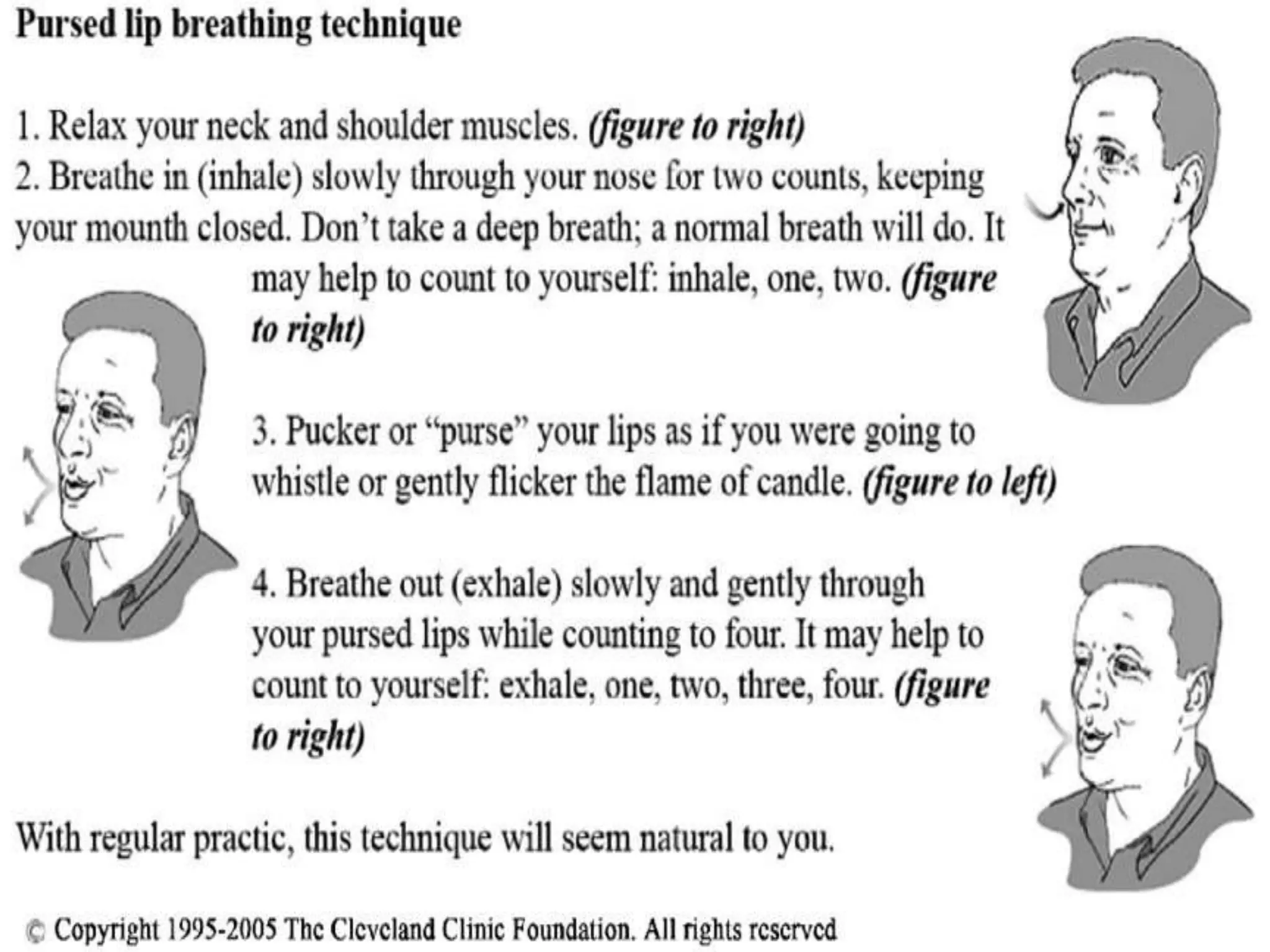 Deep breathing and coughing exercises | PDF