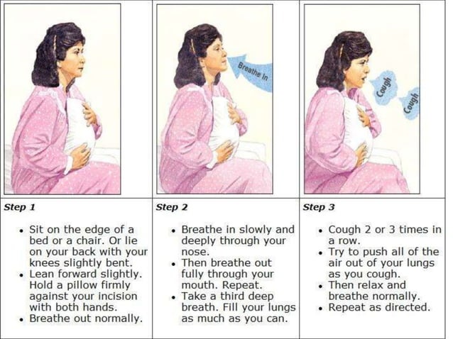 Deep breathing and coughing exercises