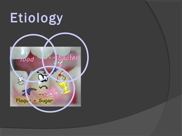 Deep caries management | PPT | Oral care | Personal Care