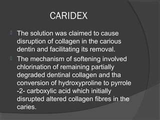 Deep caries management | PPT