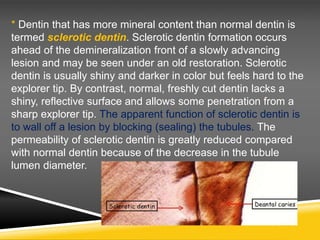 management of deep seated caries | PPTX