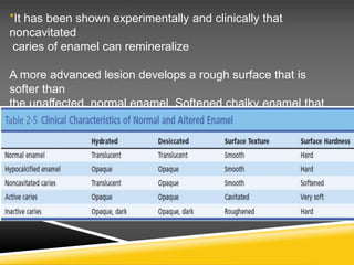 management of deep seated caries | PPTX