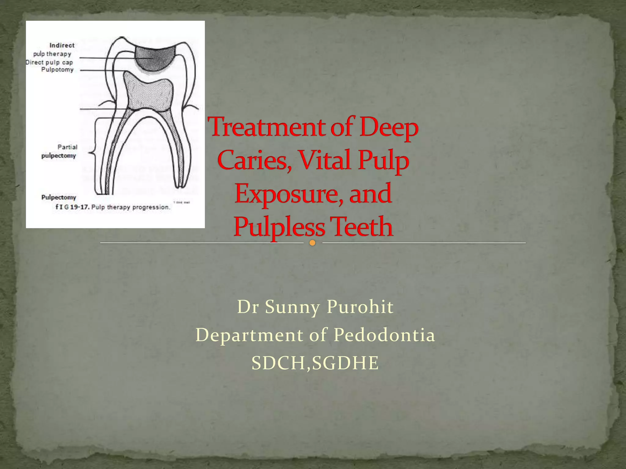 Deep carious Lesions | PPTX | Dental Health | Diseases and Conditions