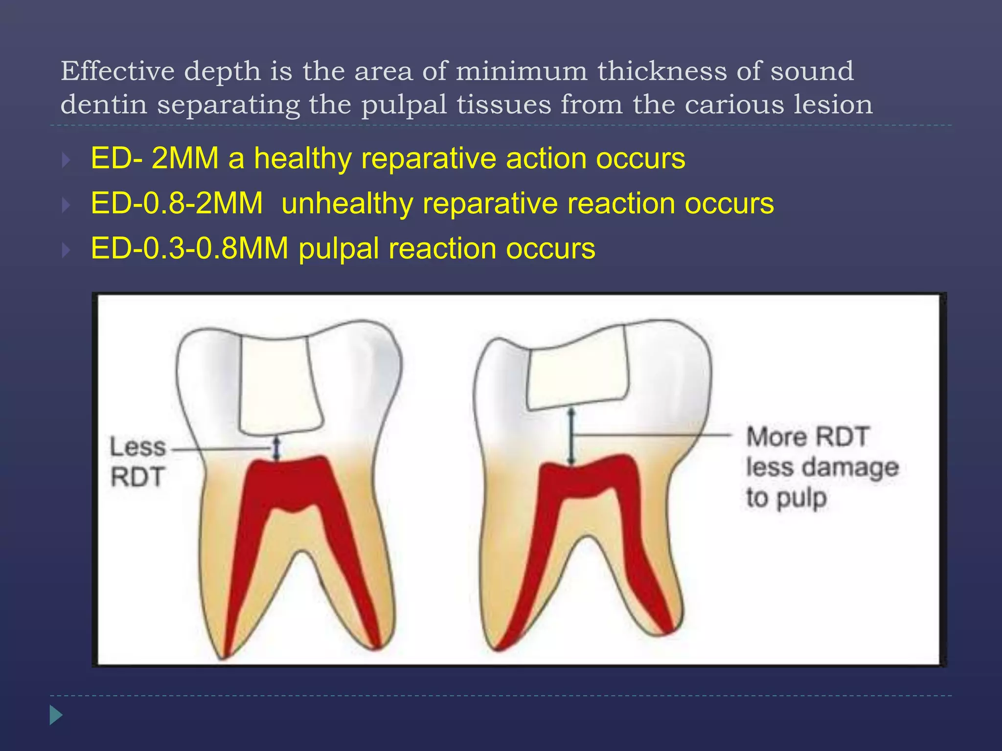 Deep carious lesions | PPTX