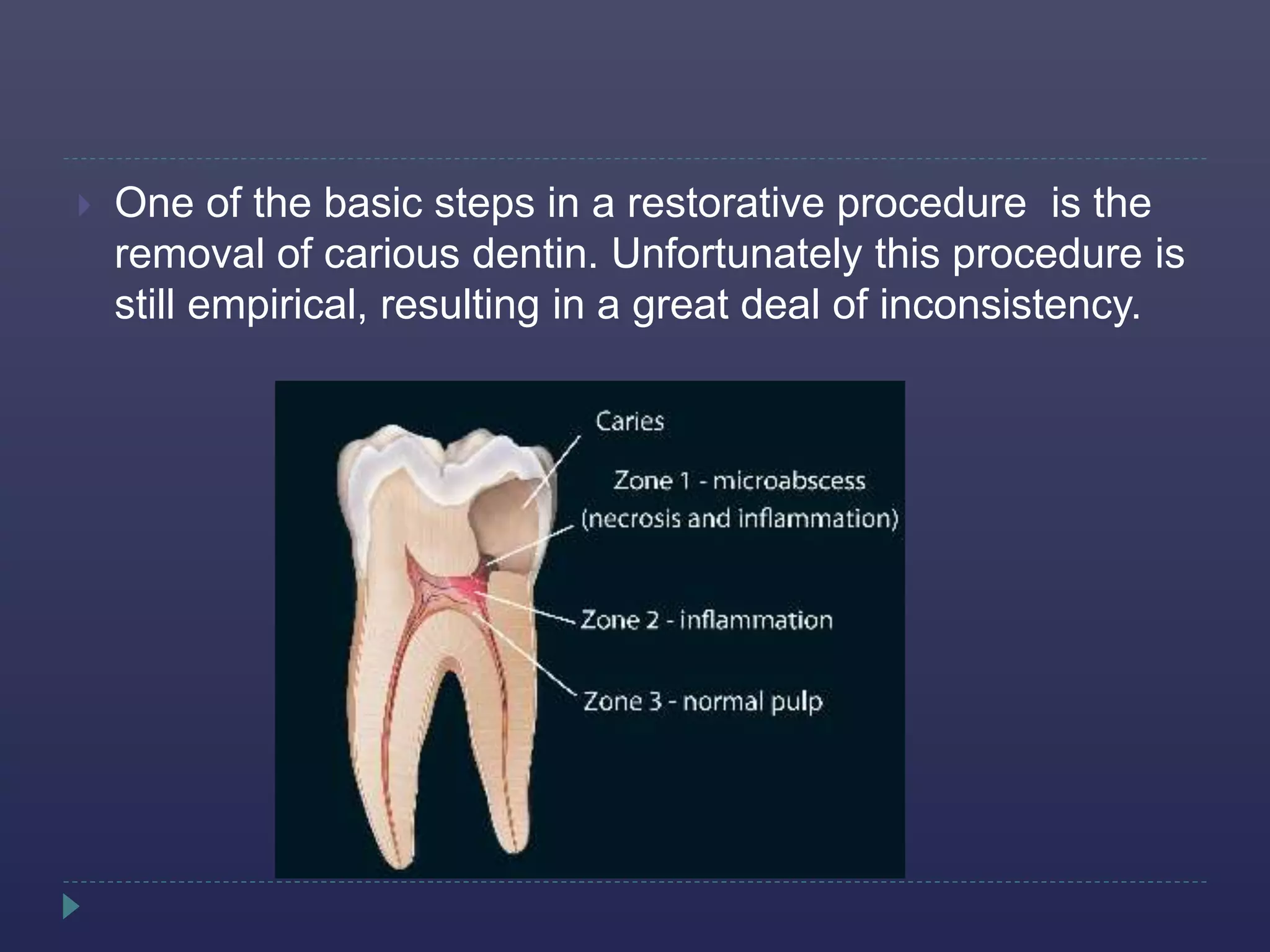 Deep carious lesions | PPTX