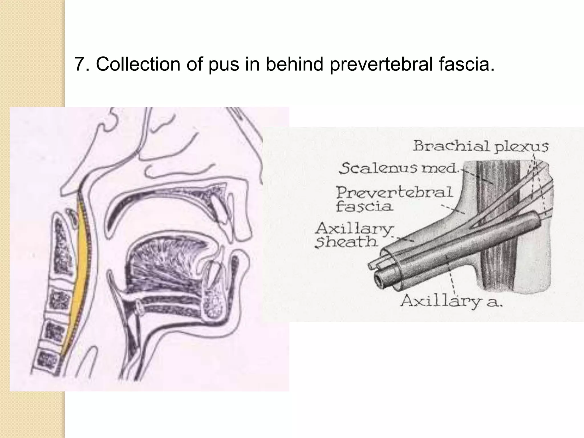 Deep cervical fascia | PPTX