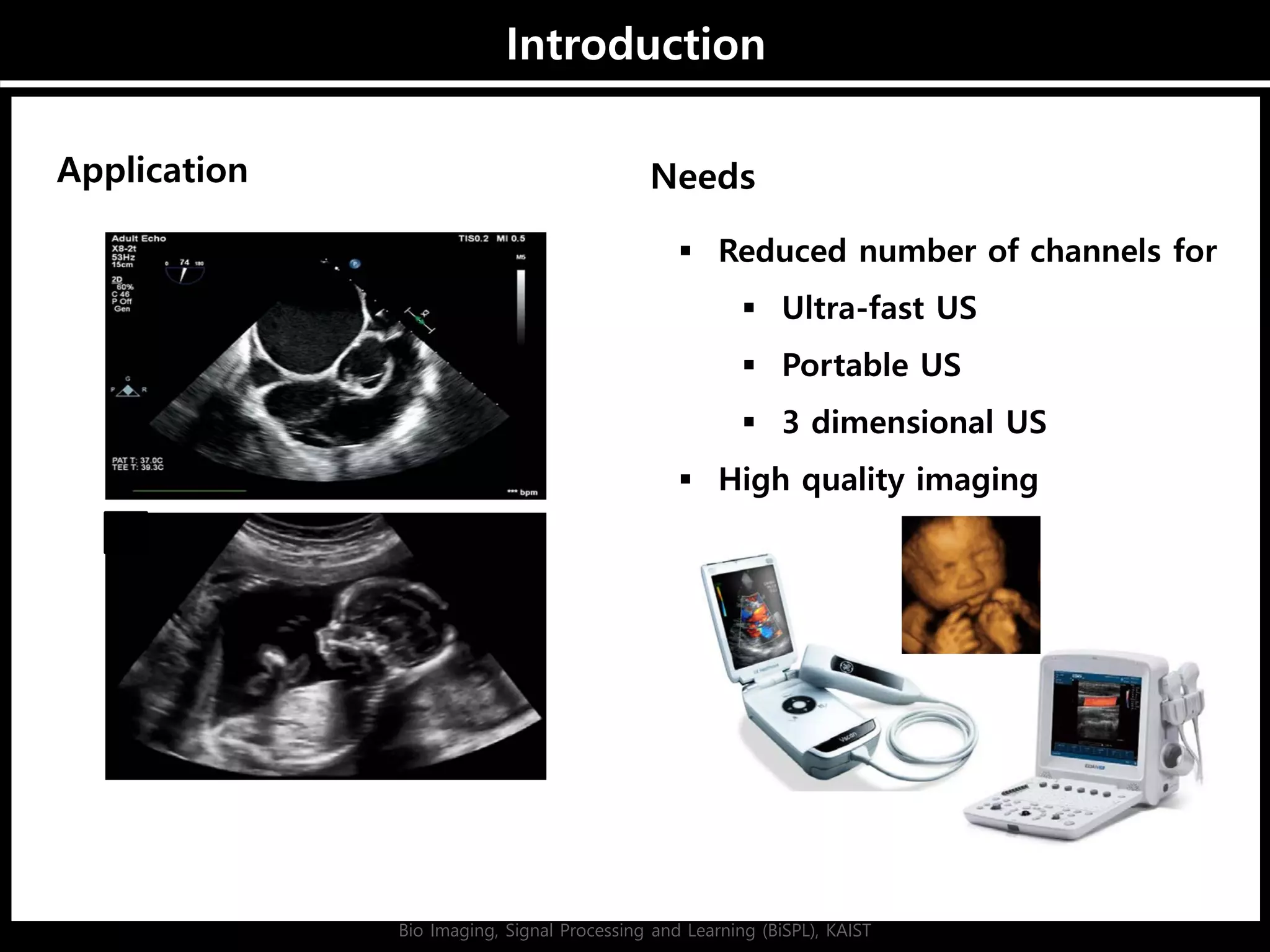 Unsupervised Deconvolution Neural Network For High Quality Ultrasound Imaging Ppt